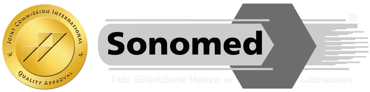 Sonomed Tıbbi Görüntüleme Merkezi ve Laboratuvar